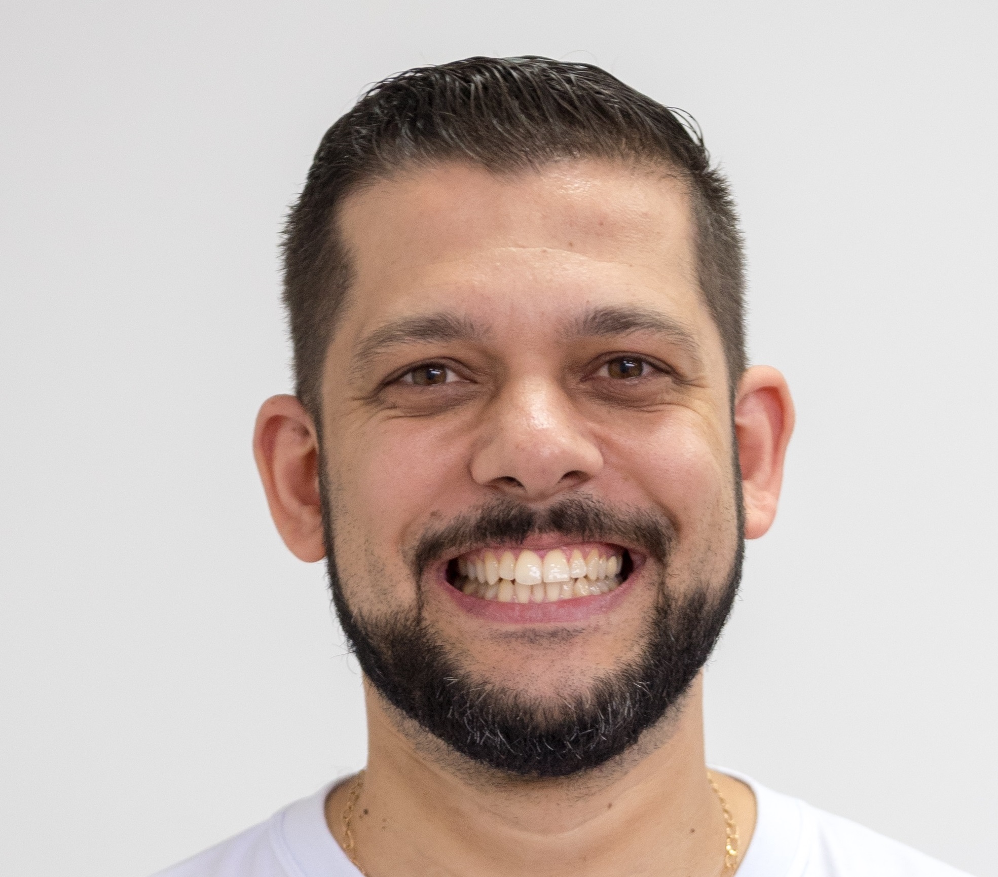 Vítima de amputação recebe doação de prótese do Rotary Club de Cruzeiro ... Vítima de amputação recebe doação de prótese do Rotary Club de Cruzeiro ...
